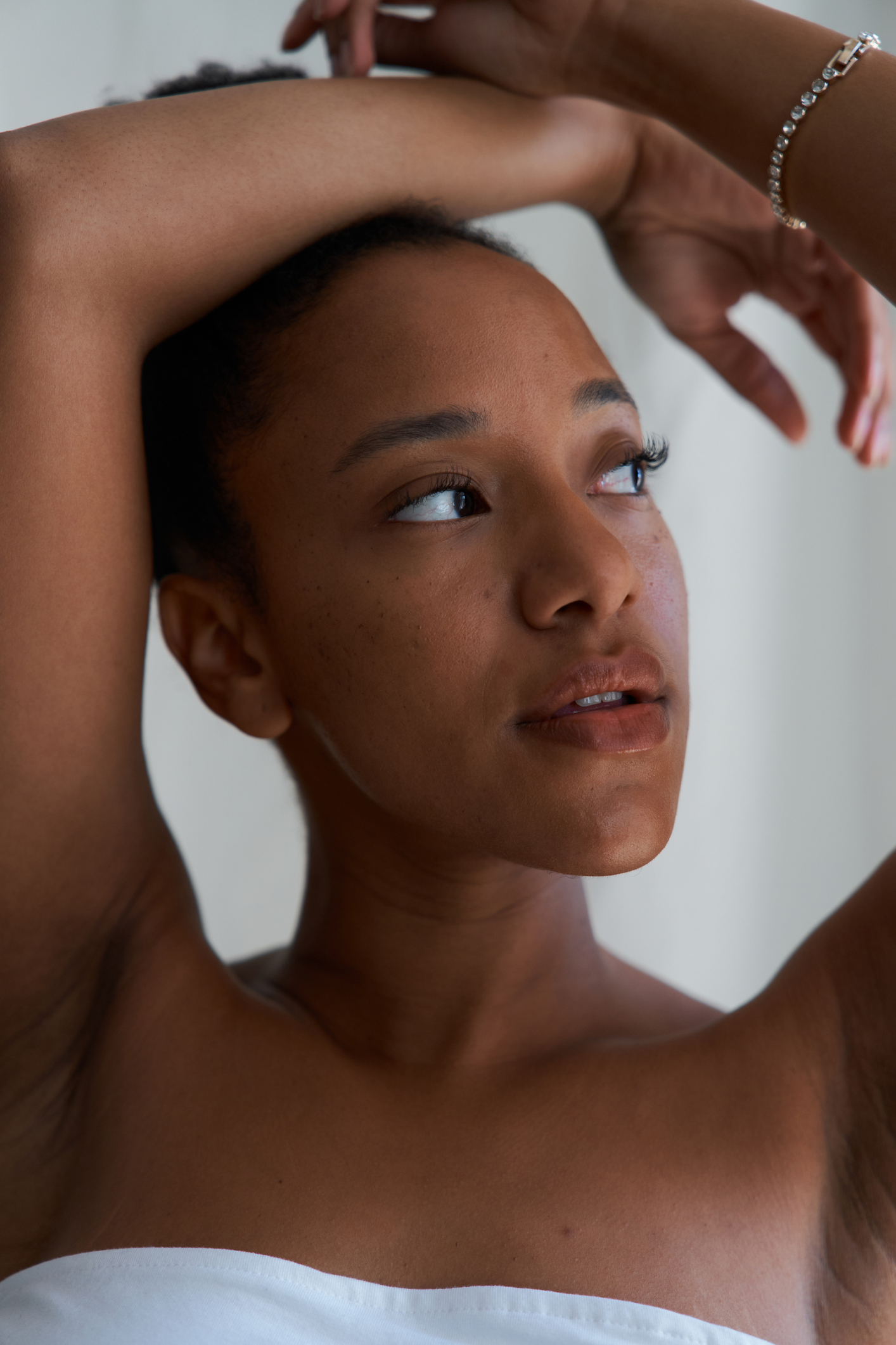 Dermatosis Papulosa Nigra (DPN) Causes, Treatments, and FAQs